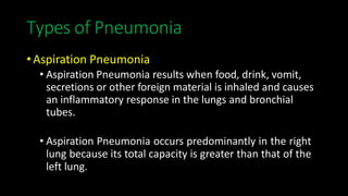 pneumonia .pptx