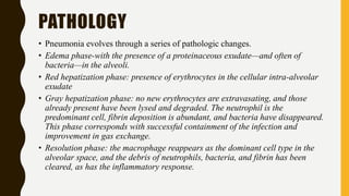 Pneumonia Lecture.pptx
