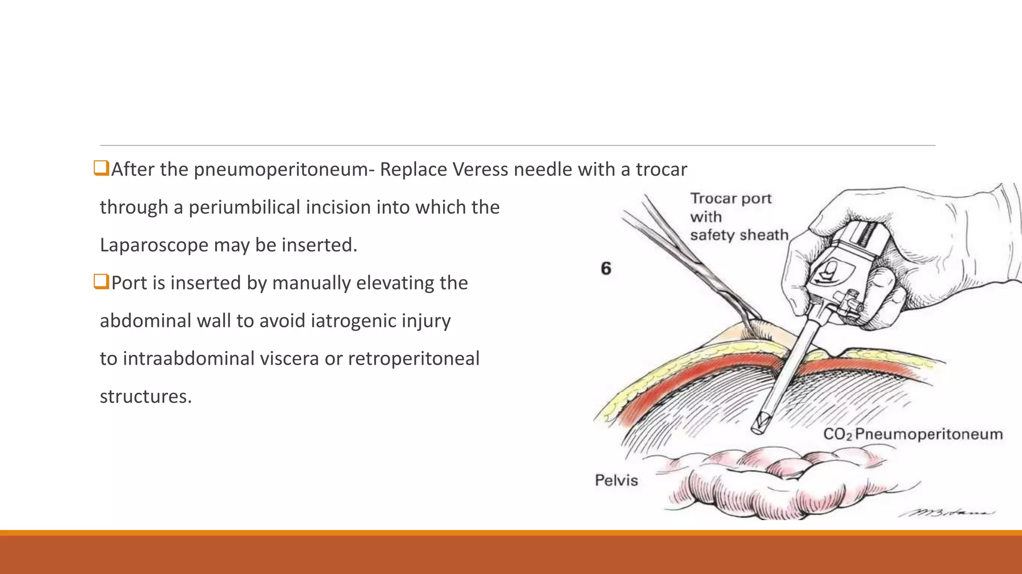 Pneumoperitoneum .pptx