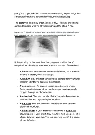 Pneumonia.docx