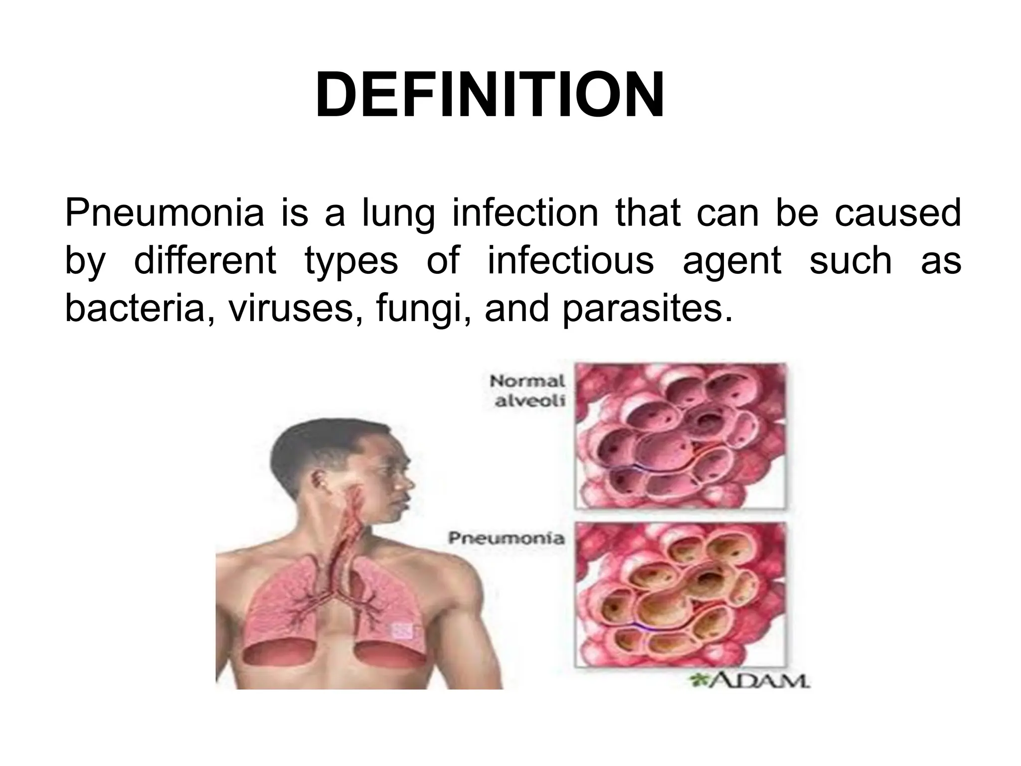 Pneumonia and its causes sign symptome treatment | PDF