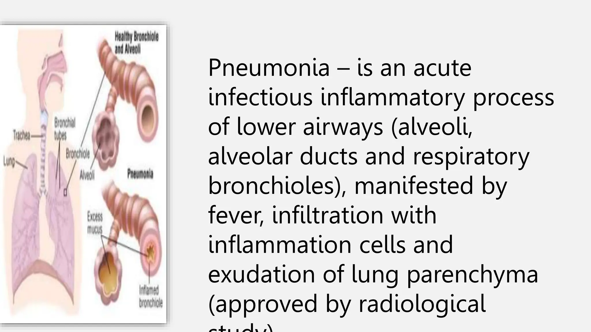 PNEUMONIA. . Anatomy. pulmonolgy mbbs | PPTX