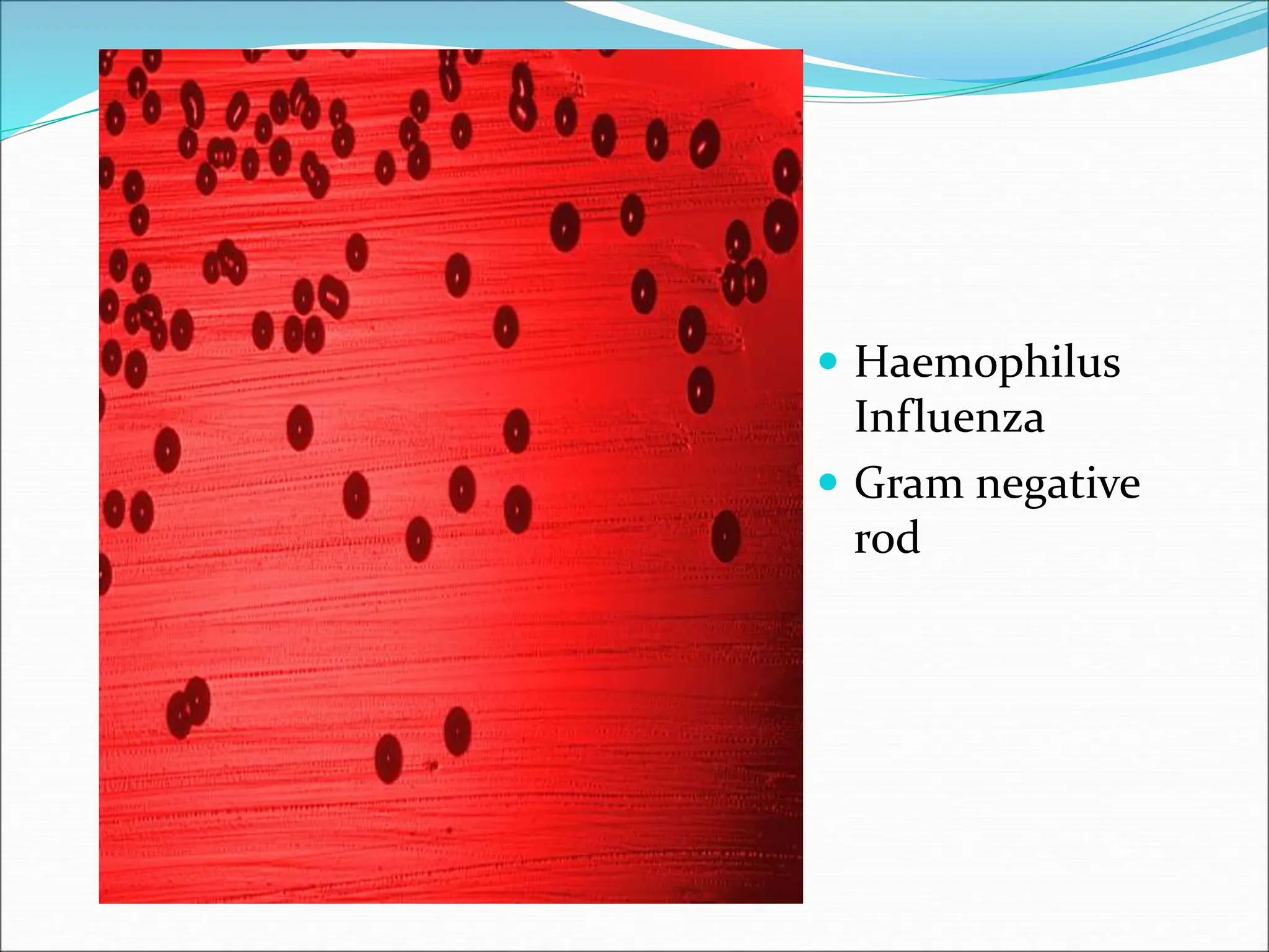 Pneumonia, definition, symptoms, causes and cure | PPT