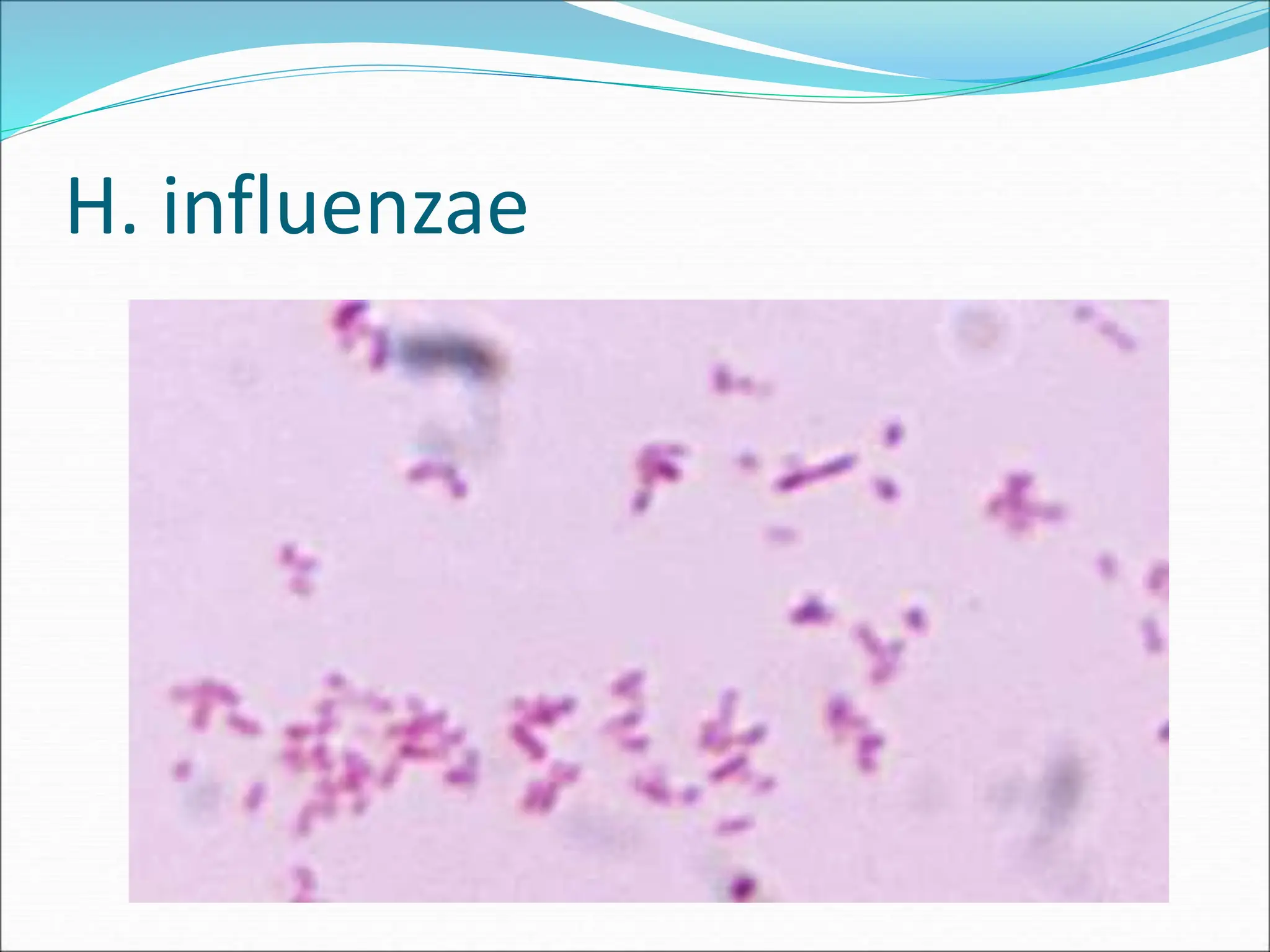 Pneumonia, definition, symptoms, causes and cure | PPT