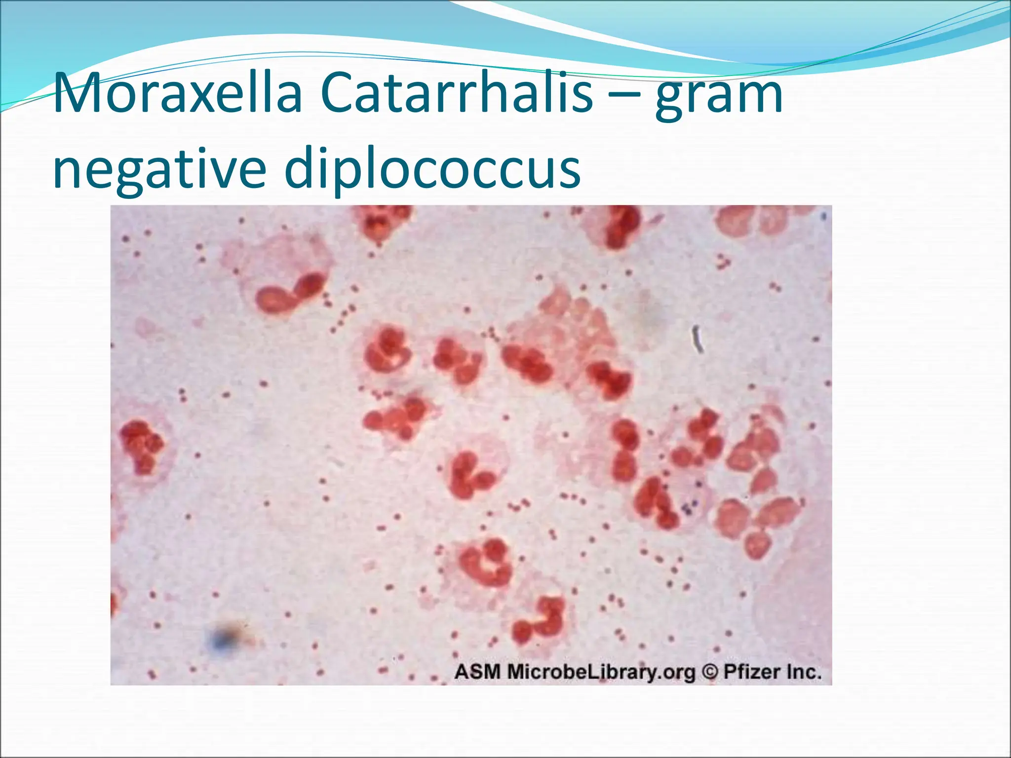 Pneumonia, definition, symptoms, causes and cure | PPT