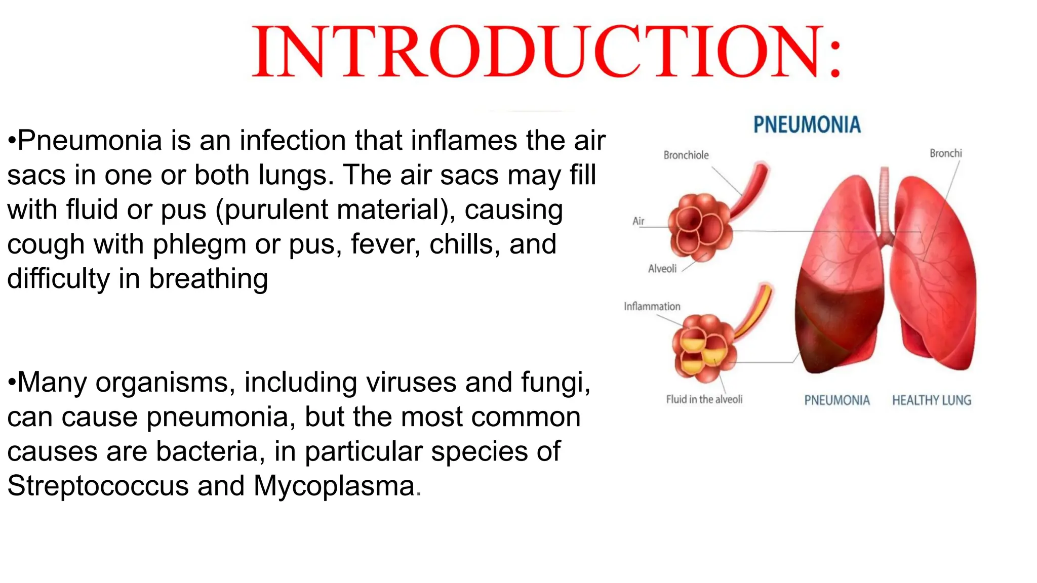 PNEUMONIA. respiratory disease presentation | PDF