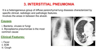 PNEUMONIA. respiratory disease presentation | PDF