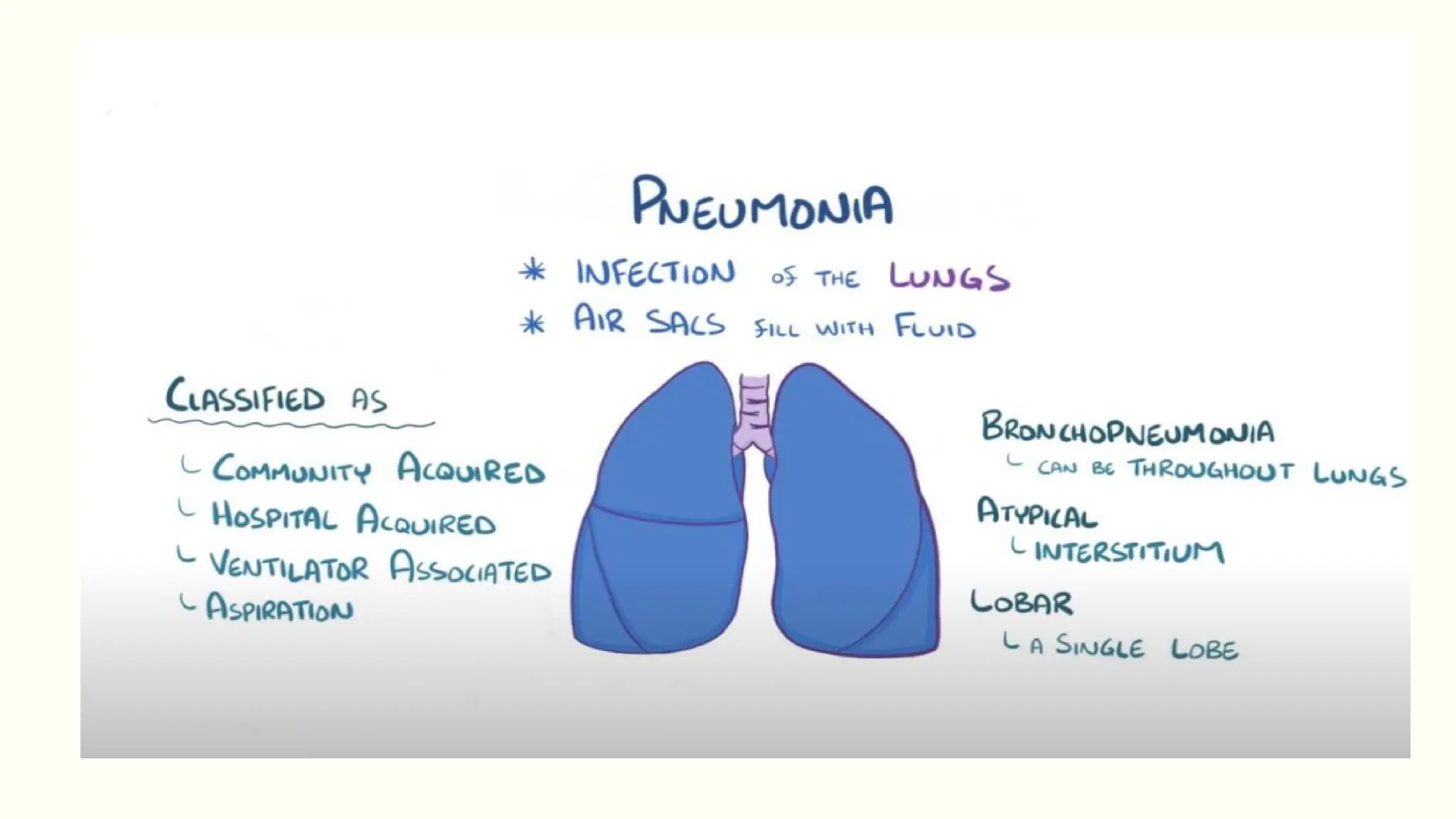 PNEUMONIA AND ITS MANAGEMENT WITH TREATMENT.pptx