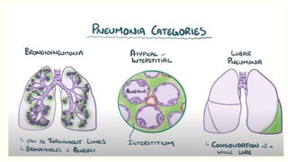 PNEUMONIA AND ITS MANAGEMENT WITH TREATMENT.pptx