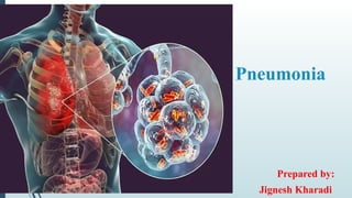 Pneumonia. (Pathology ) pptx | PPTX
