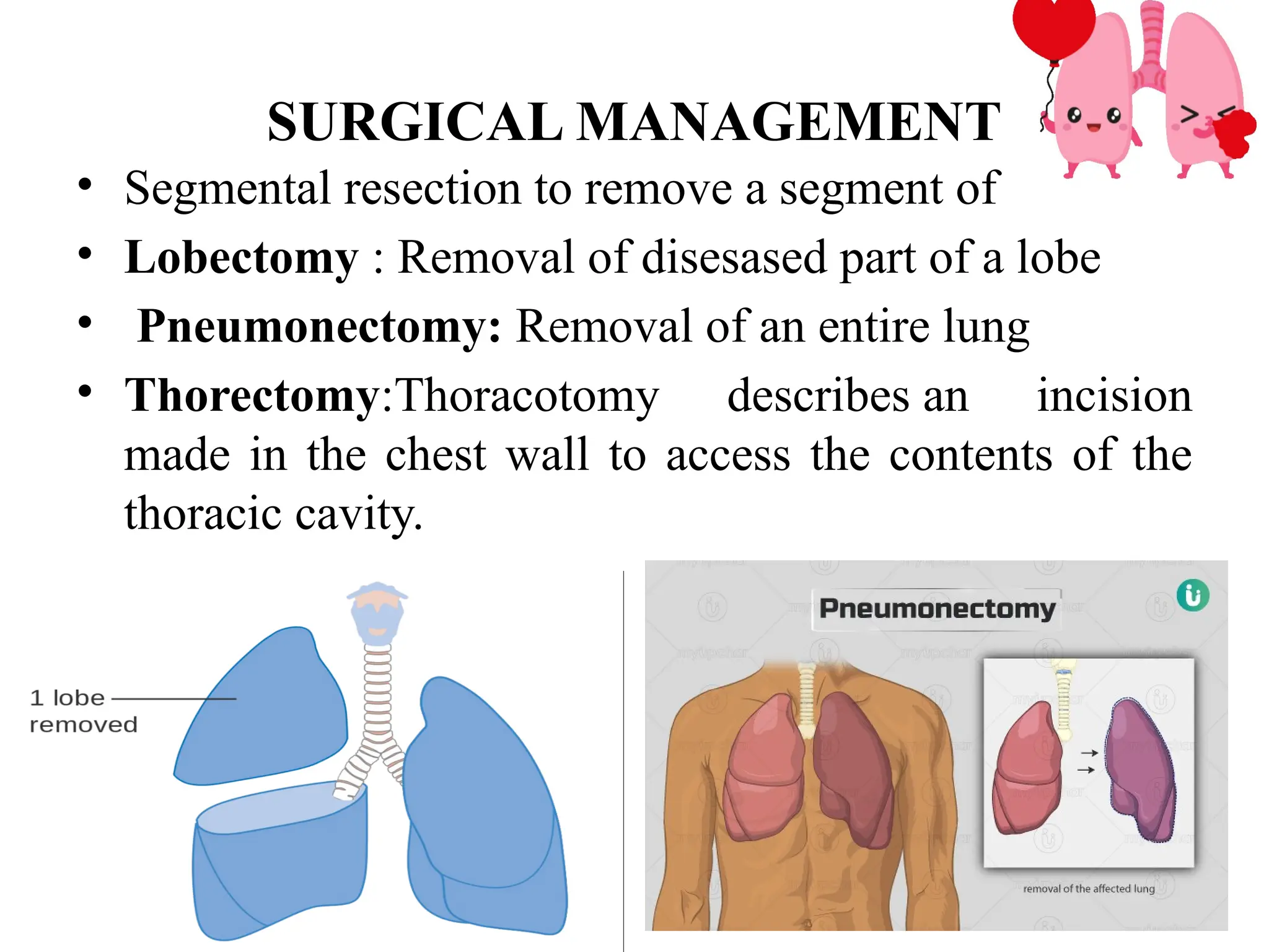 PNEUMONIA.pptx......... ................ | PPTX