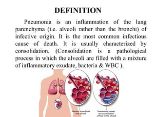 PNEUMONIA.pptx......... ................ | PPTX