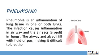 Pneumonia in english | PPTX
