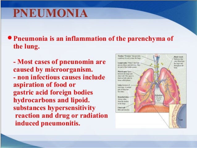 classification of pnemonia