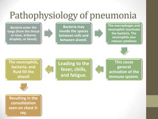Pneumonia | PPT