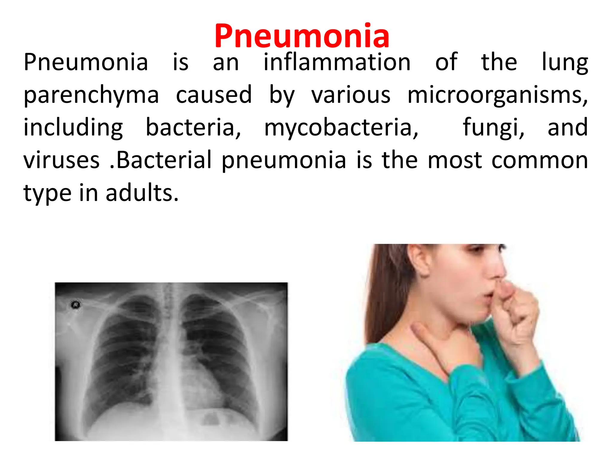 pneumonia and cholecystitis.pptx