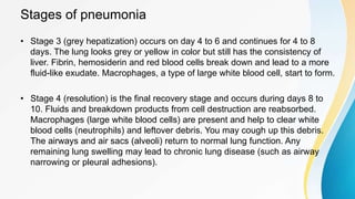 Pneumonia (anurag yadav).pptx
