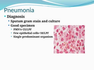 Etiology, pathogenesis, clinical features of pneumonia | PPTX