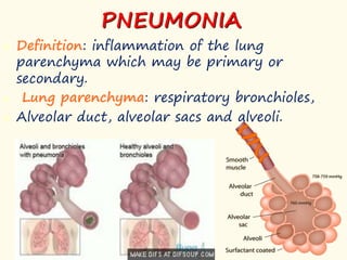 Pneumonia by safiullah | PPT