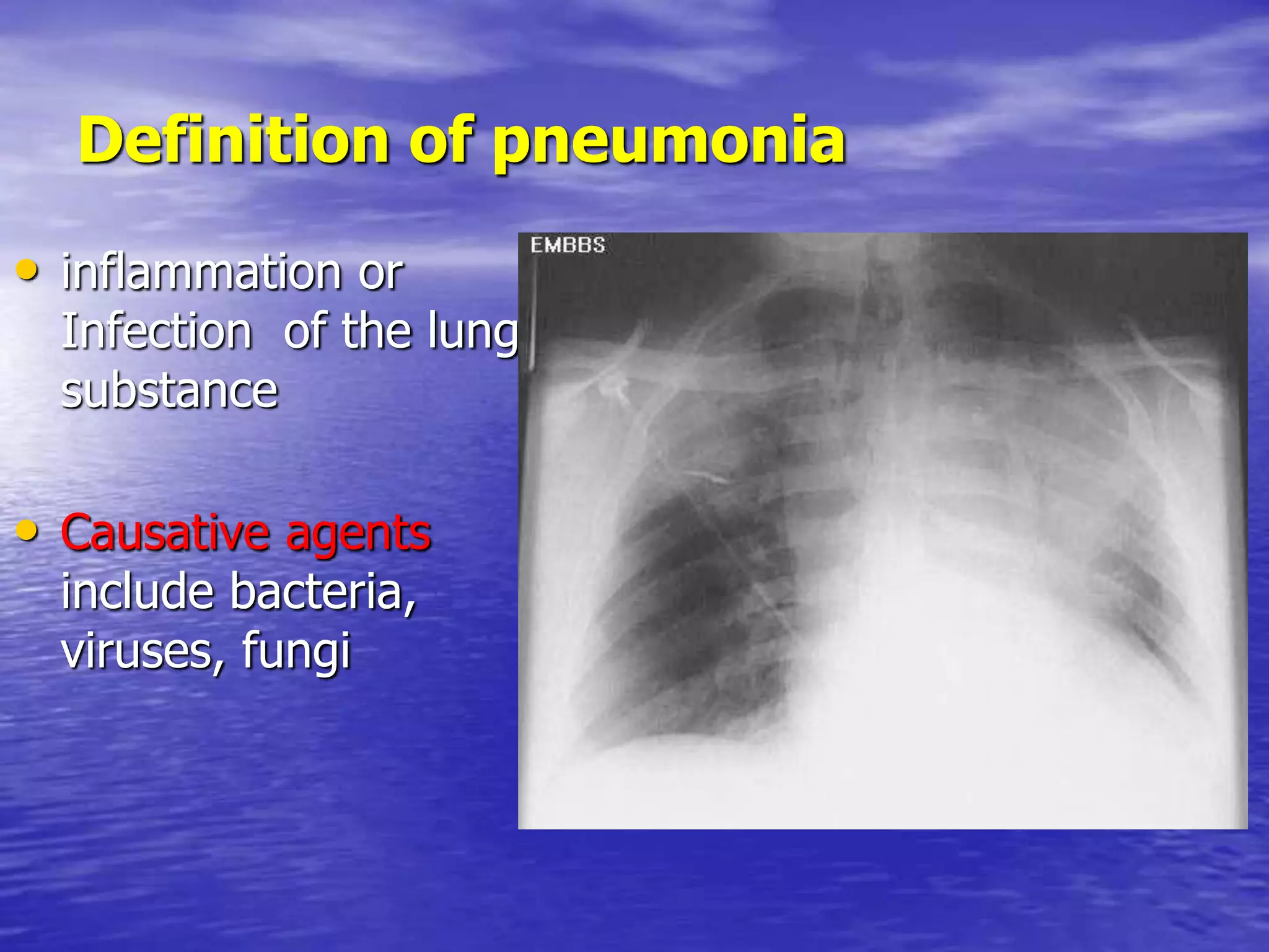 Pneumonia & ITS Complications | PPT