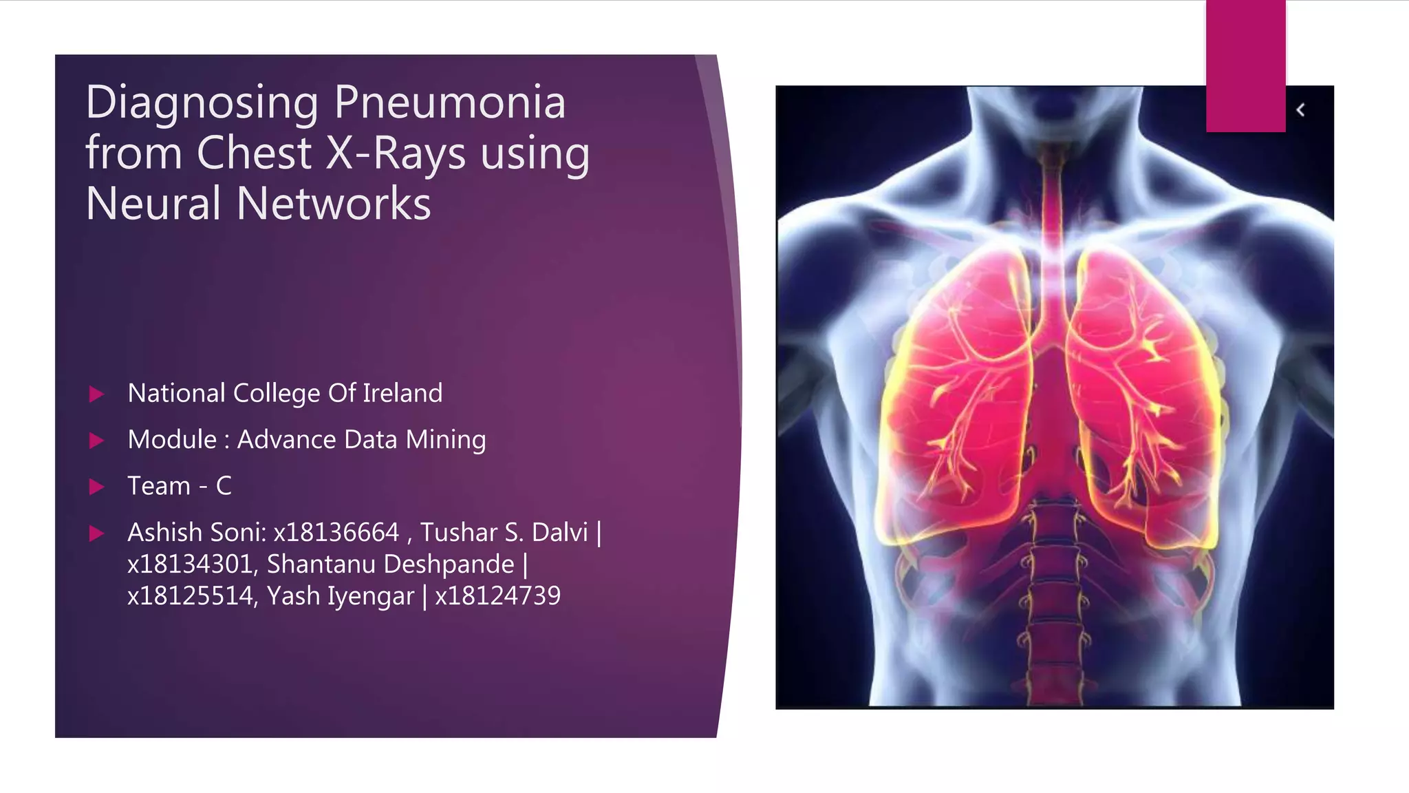 Pneumonia detection using cnn | PPTX