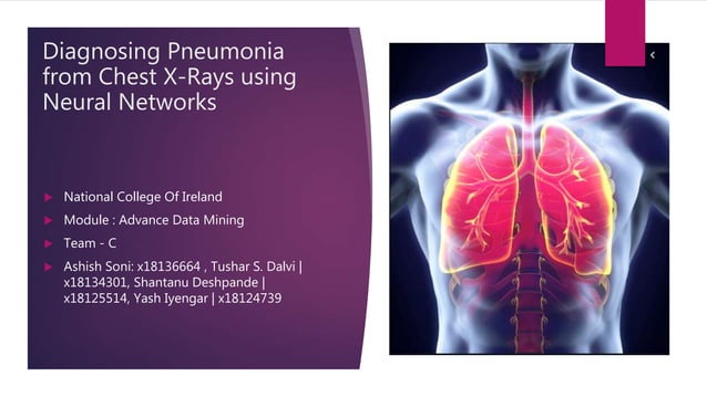 Pneumonia detection using cnn | PPT