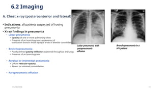 Pneumonia ands illnesses of the lungs by Dr. Issa | PPTX
