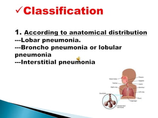 Pneumonia in children | PPTX
