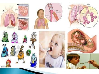 Pneumonia in children | PPTX