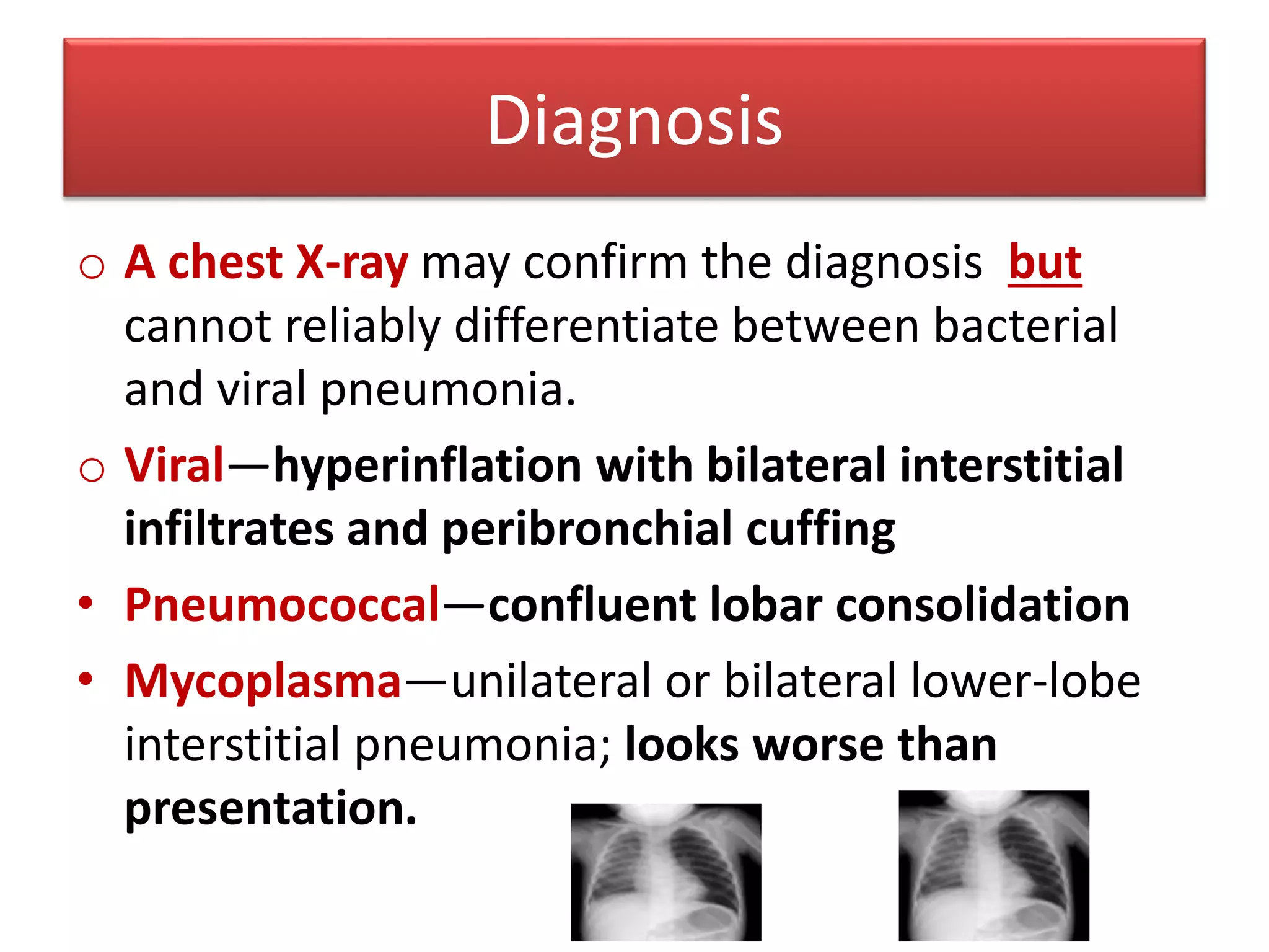 Pneumonia in children | PPTX