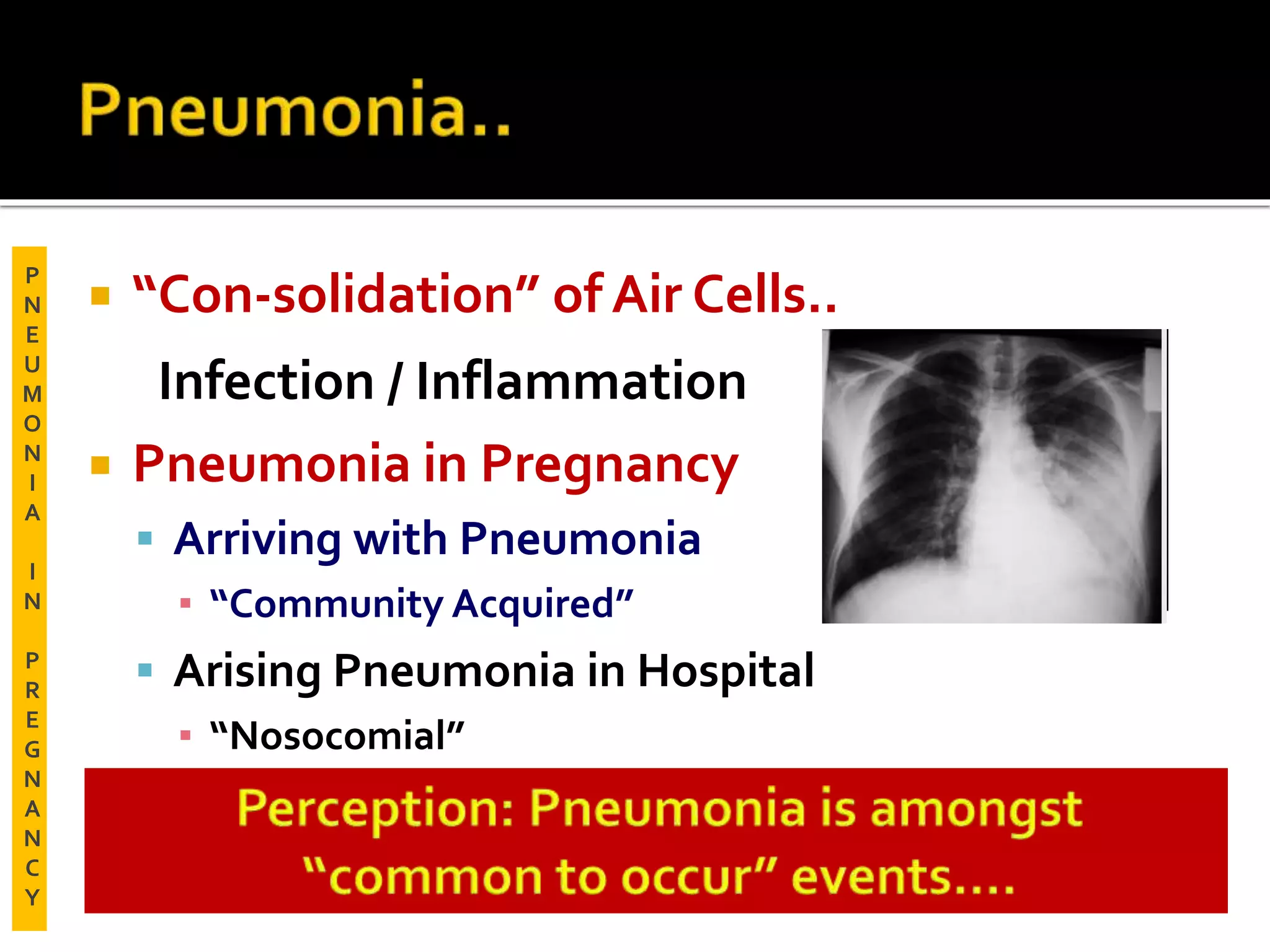 Pneumonia in pregnancy april2018 pmm_aogs | PPTX