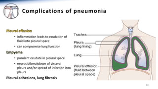 Pneumonia_I_Pathophysiology_and_Clin_Presentation.pptx