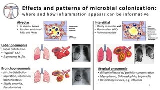 Pneumonia_I_Pathophysiology_and_Clin_Presentation.pptx