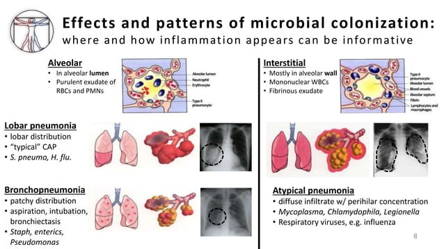 Pneumonia_I_Pathophysiology_and_Clin_Presentation.pptx