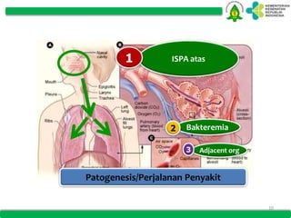 Pneumonia Kemkes.pptx