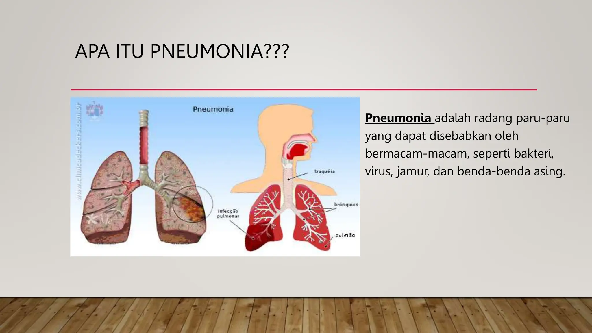 pneumonia mdt penyuluhan pptx anakt.pptx