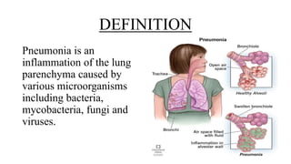pneumonia respiratory system disease for Nursing | PPT