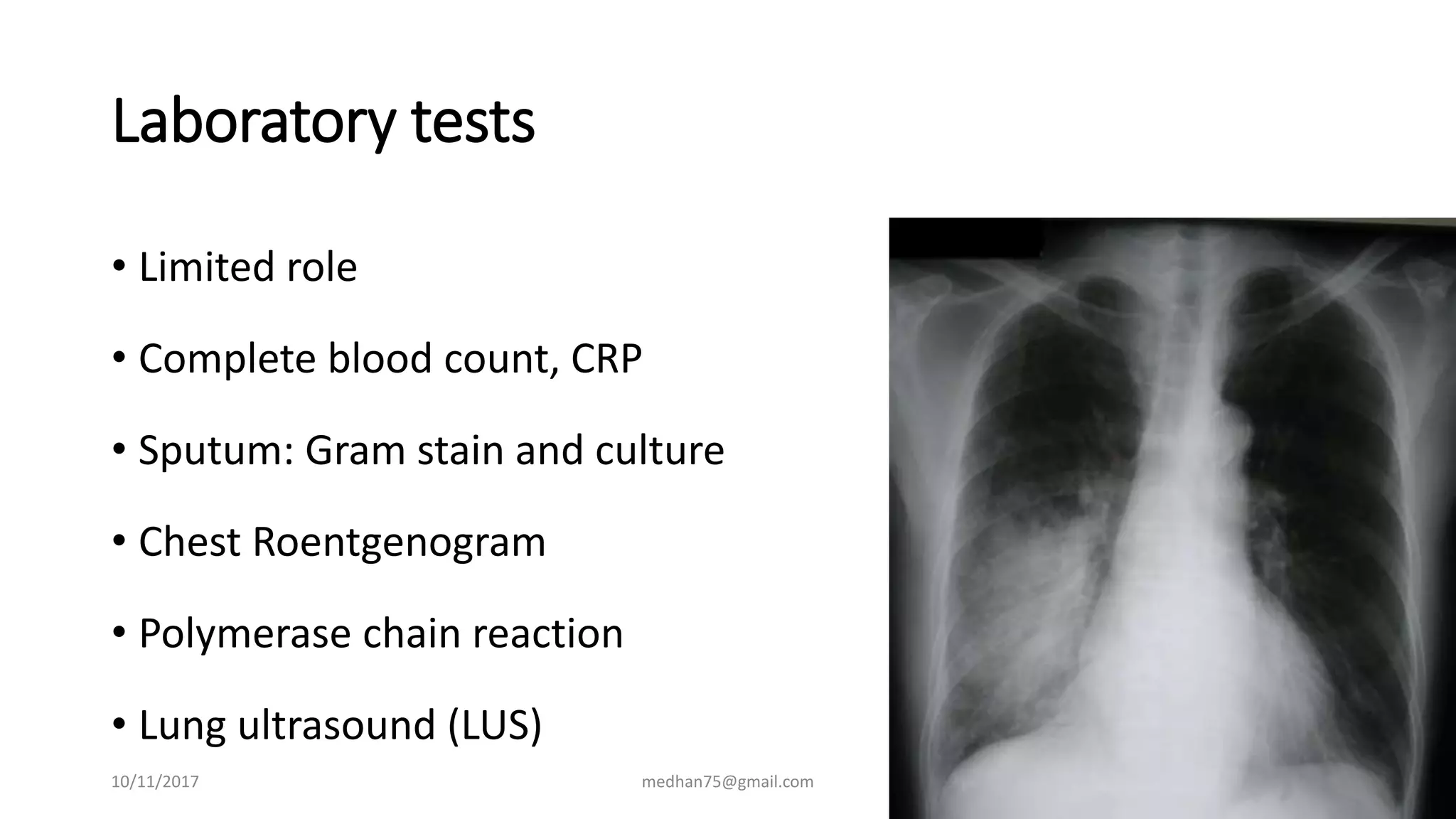 Pneumonia, paediatric perspective | PPTX