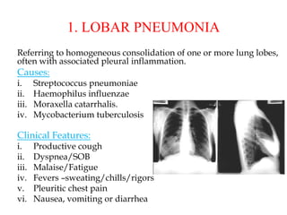 Chest X Ray Lobar Pneumonia