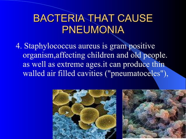 FUNGAL PNEUMONIA BY DR BASHIR AHMED DAR ASSOCIATE PROFESSOR MEDICINE ...