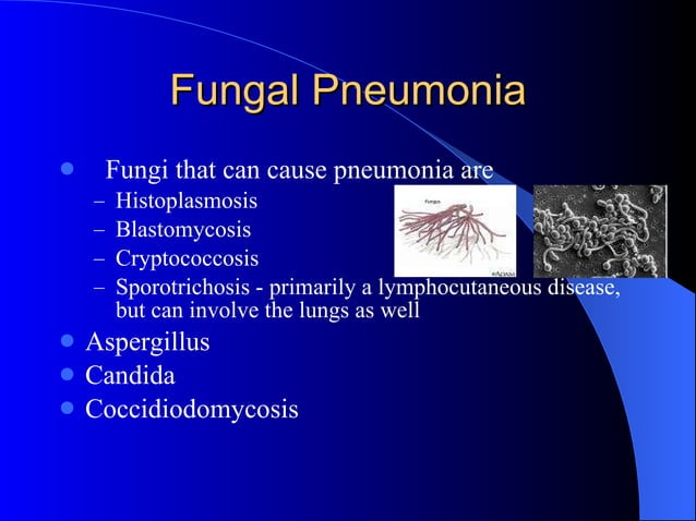 FUNGAL PNEUMONIA BY DR BASHIR AHMED DAR ASSOCIATE PROFESSOR MEDICINE ...