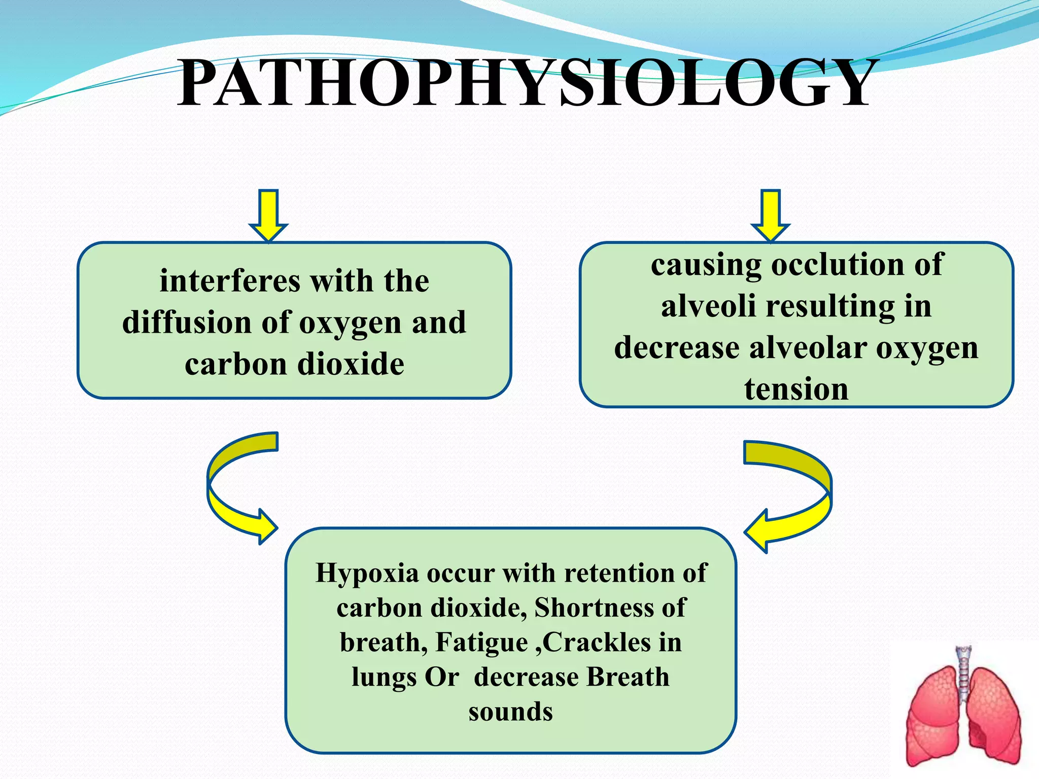 Pneumonia seminar presentaation | PPTX