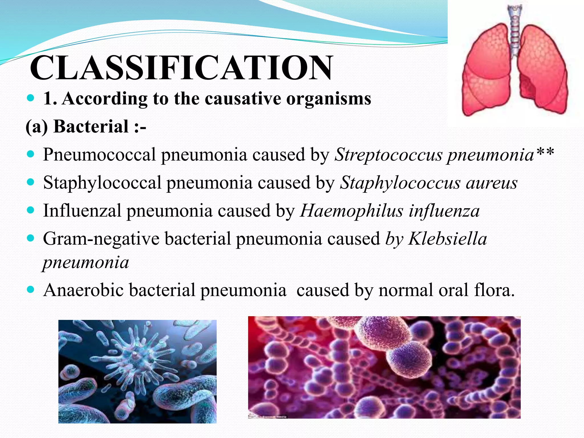 Pneumonia seminar presentaation | PPTX
