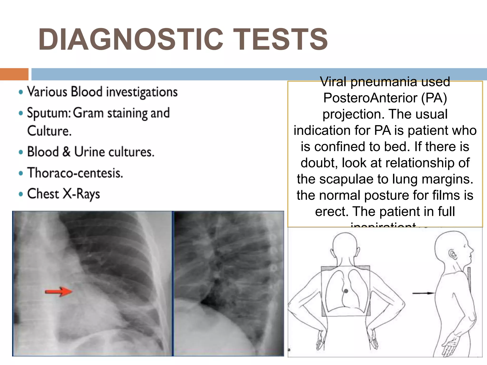 Diagnostic Test Viral Pneumonia study case | PPTX
