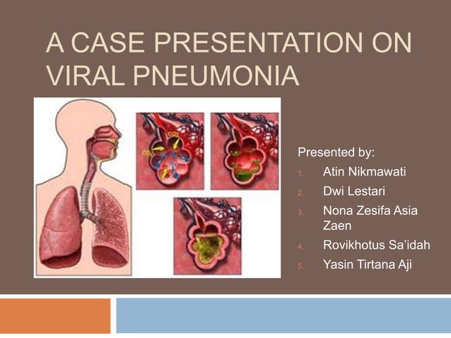 Diagnostic Test Viral Pneumonia study case | PPT