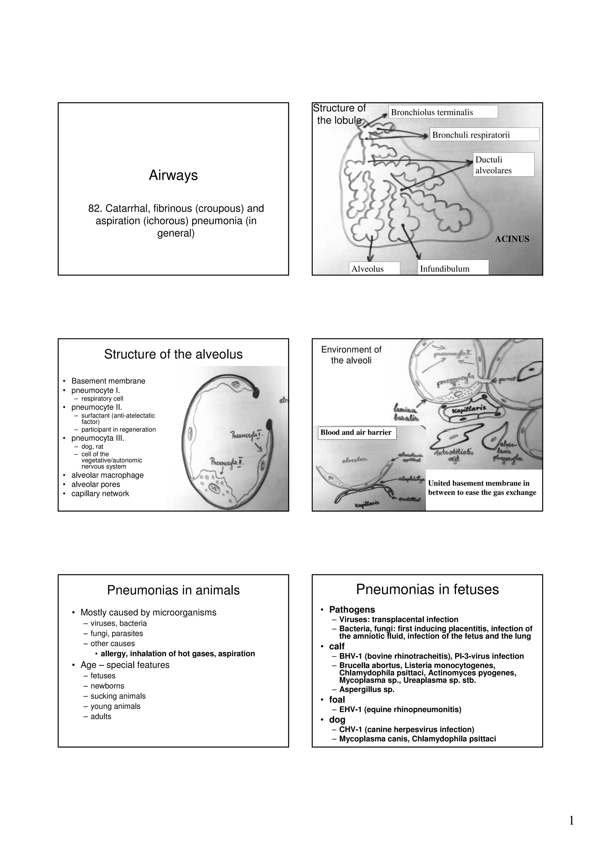 Pneumonia subtypes | PDF