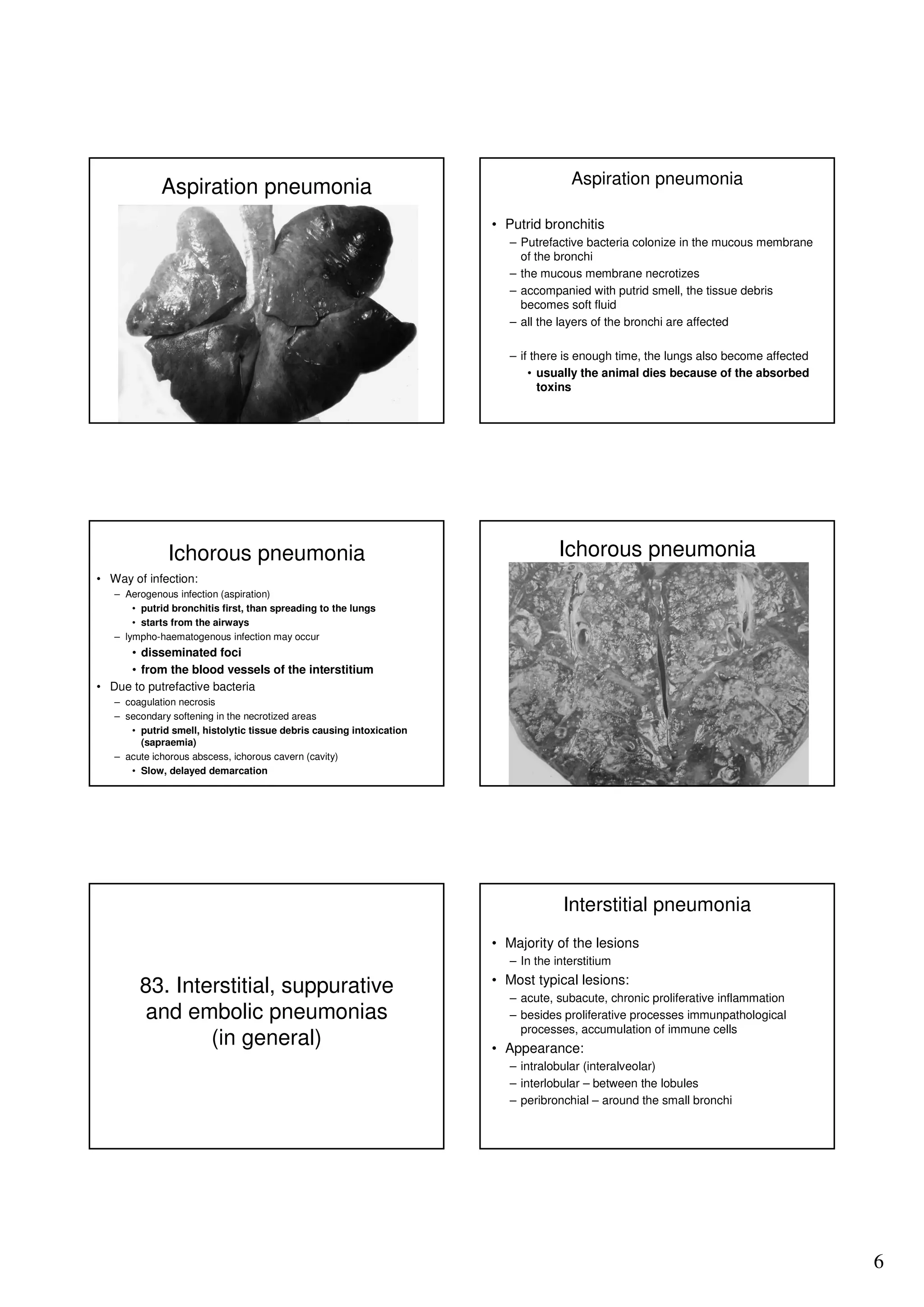 Pneumonia subtypes | PDF
