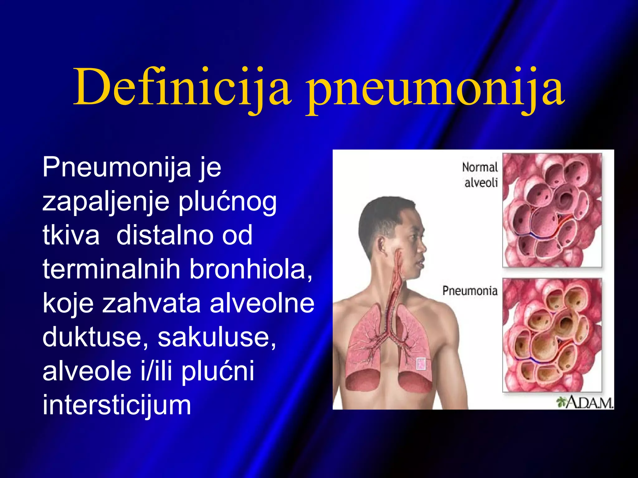 Pneumonije | PPT