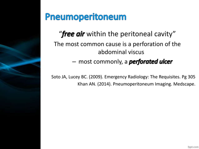 Signs of Pneumoperitoneum on Plain Film | PPTX | Lung and Respiratory ...