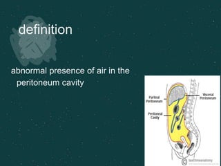 Pneumoperitoneum x ray | PPTX